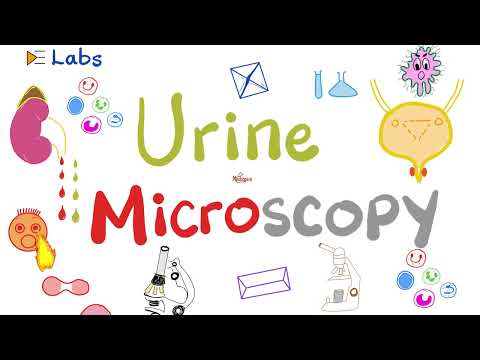 Urine Microscopic Examination - RBCs, WBCs, Tubular Casts - Urinalysis - Labs