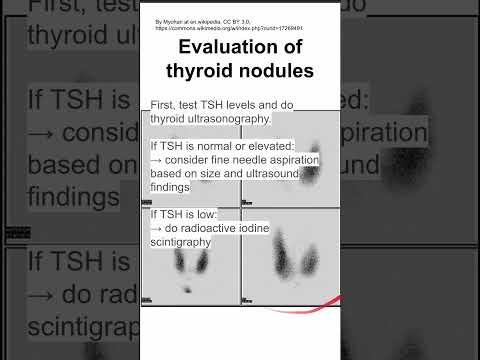 Evaluation of thyroid nodules