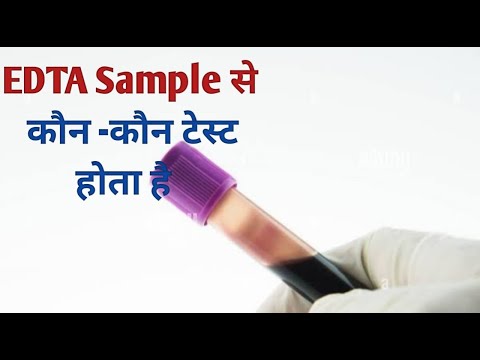 Which test to be done in edta I Tanu Path