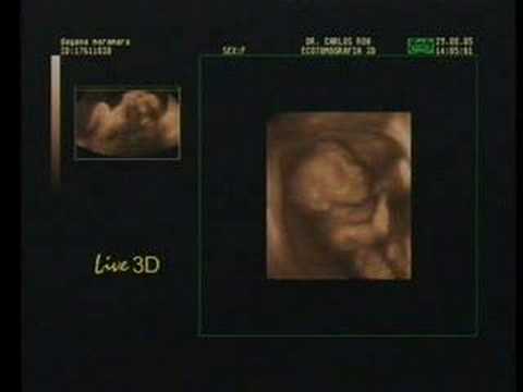 ECO 3D-4D UNA VISION DIFERENTE EN ULTRASONIDO OBSTETRICO | CEIUM ...