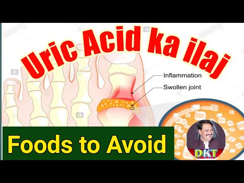 uric acid treatment | foods to avoid | uric acid ka ilaj | ilyas adil
