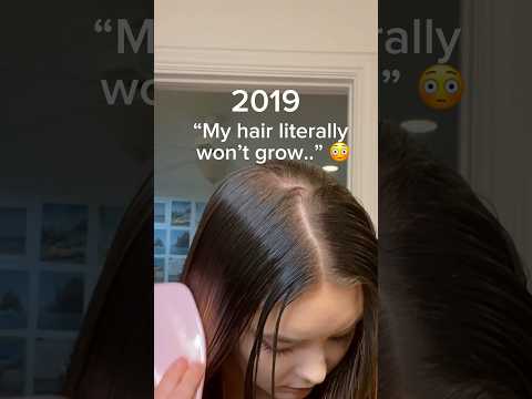 My viral Rosemary Oil for hair growth π€β¨ππ» #haircare #rosemaryoil