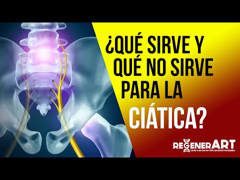 ¿Qué sirve y qué no sirve para la ciática?