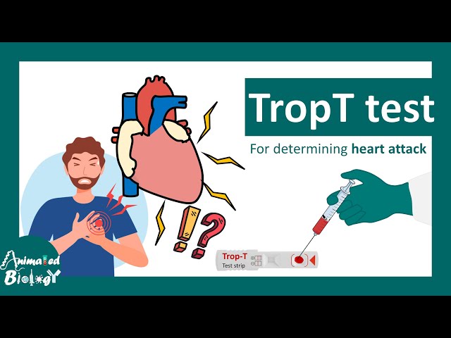 Test Kit - Trop T Sensitive Kit Trader - Wholesaler / Distributor from ...