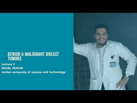 PHYLLODES TUMORS | BENIGN BREAST TUMORS | GALACTOCELE | FIBROADENOMAFIBROCYSTIC CHANGES