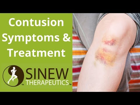 Contusion Symptoms and Treatment