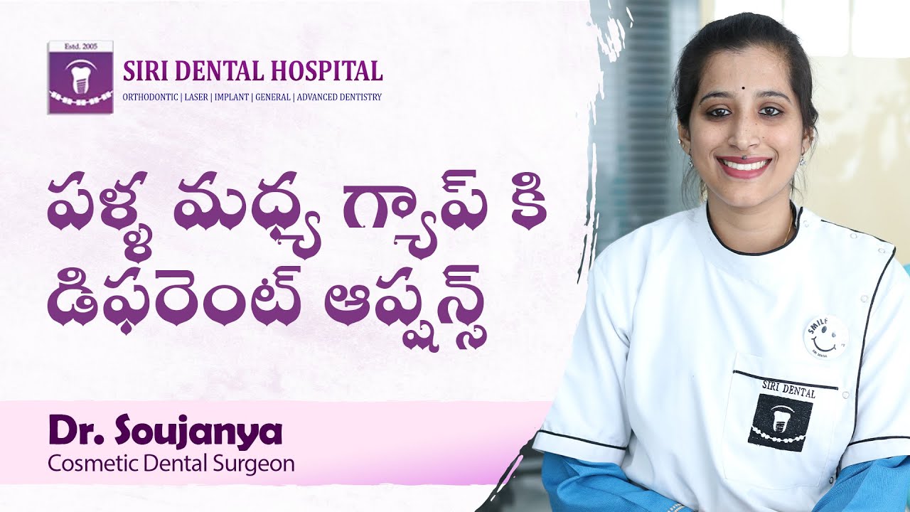 Checkout the options to fix gap between teeth | Siri Dental Hospital | Invisalign Hyderabad