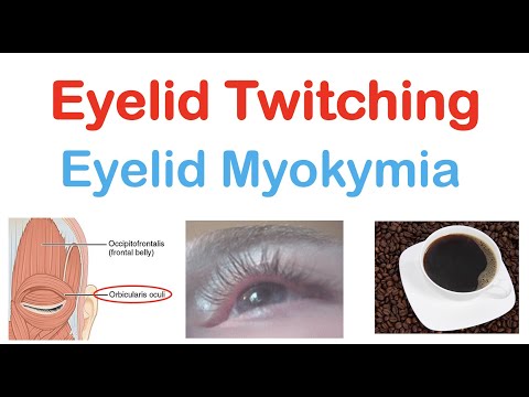 Eyelid Twitching (Eyelid Myokymia) | Triggers, Pathophysiology, Symptoms, Diagnosis, Treatment