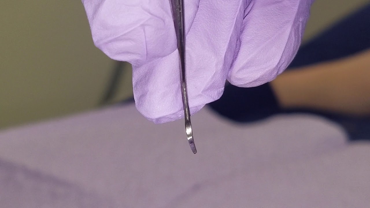 Anterior Gracey Curet Demo