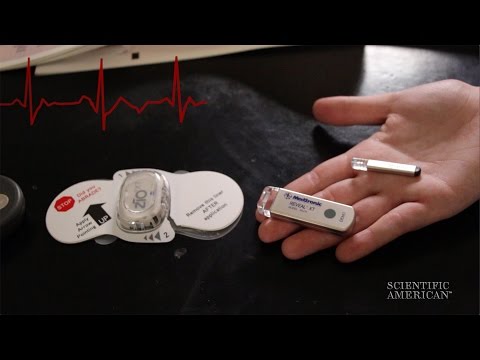 Size Matters – For Heart Monitors