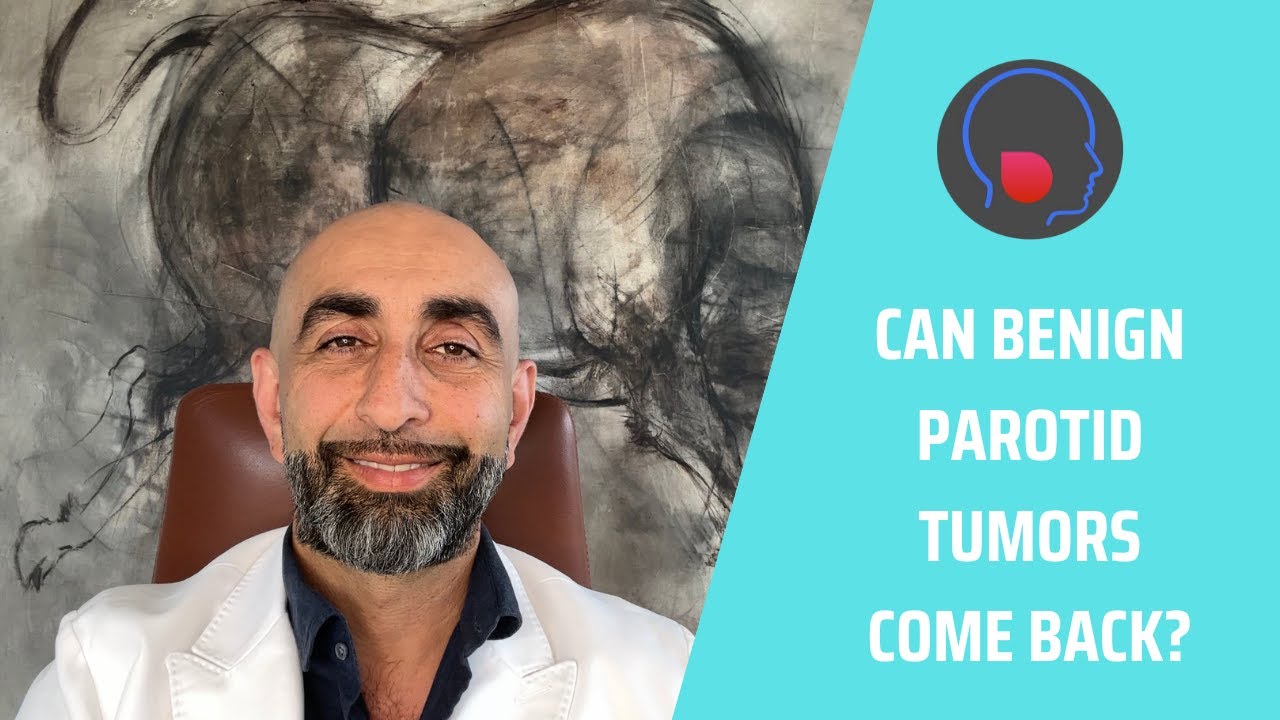 Can benign parotid tumors come back? | Causes and treatment