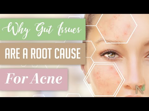 Root Cause For Acne