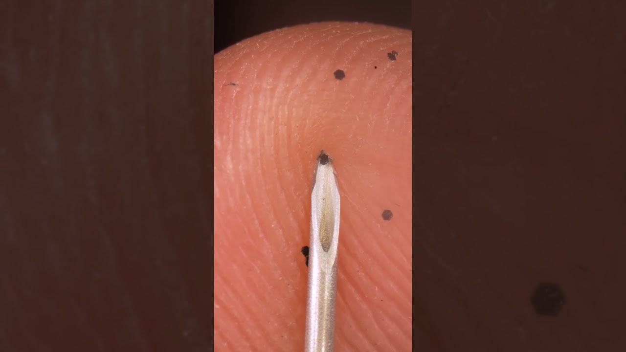 ASMR syringe under index finger skin CLOSE-UP ( macro - zoom in) #asmr #asmrsounds #closeup