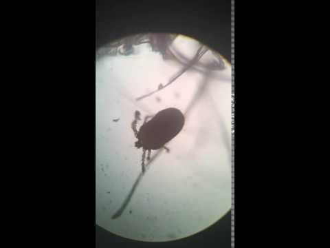 A Harvest Mite under the microscope!