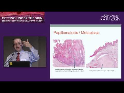 Pathology and Dermatoscopy reports what does the terminology mean Dr Ian McColl