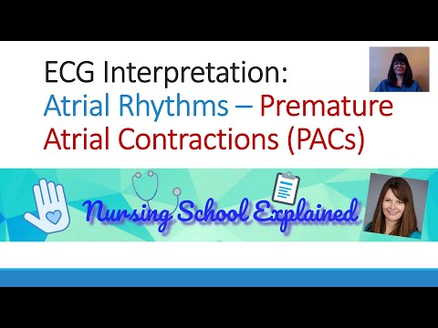 Premature Atrial Contractions (PACs)