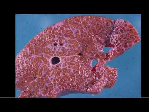 Gross Path of the Liver and Gallbladder in Swine