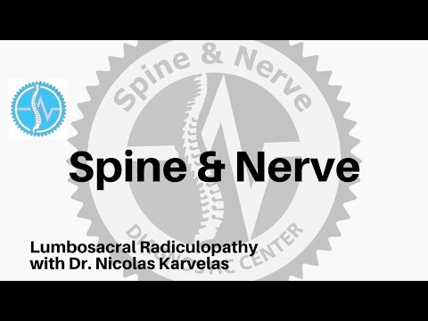 Dr. Karvelas on Lumbosacral Radiculopathy