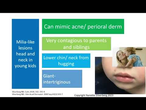 Sponsored Webinar: Advances in Understanding and Managing Molluscum in Children