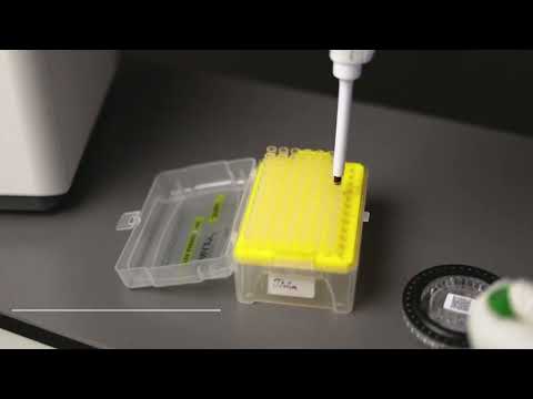 Fully Automated Biochemistry Analyzer - Automatic Chemistry Analyzer ...