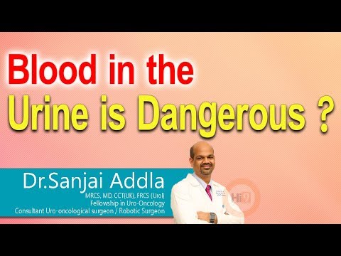 Hi9 | Blood in the Urine is Dangerous? | Hematuria | Blood cancer | Dr.Sanjai Addla | Uro oncologist