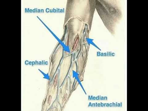 Veins of upper limb median cubital basilic cephalic median cubital antebrachial