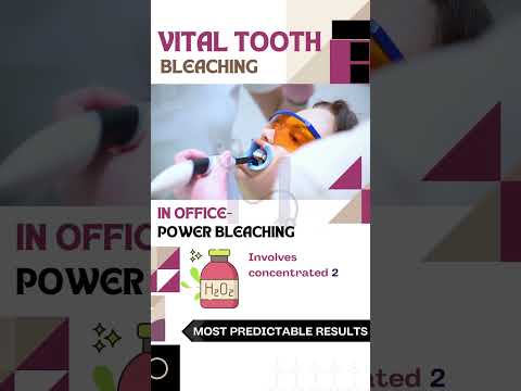 TEETH BLEACHING | HIGHLIGHTS AND METHODS