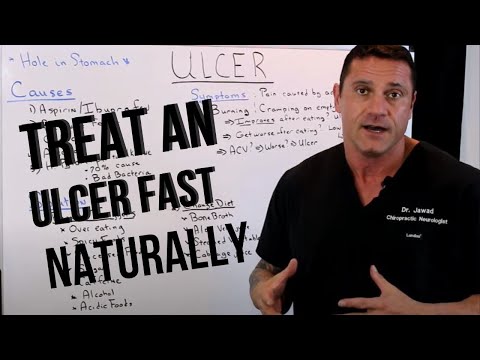 How To Treat An Ulcer Fast Naturally?
