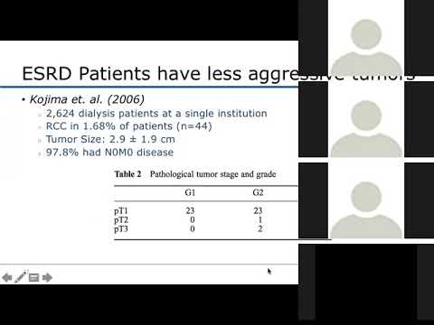Renal Cell Carcinoma in End Stage Renal Disease: Characteristics, Screening, and Treatment