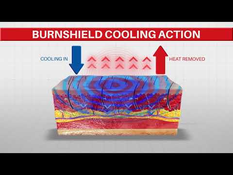 How Does Burnshield Work?