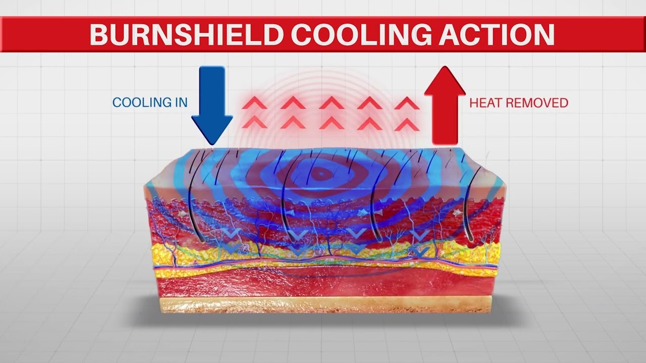How Does Burnshield Work?