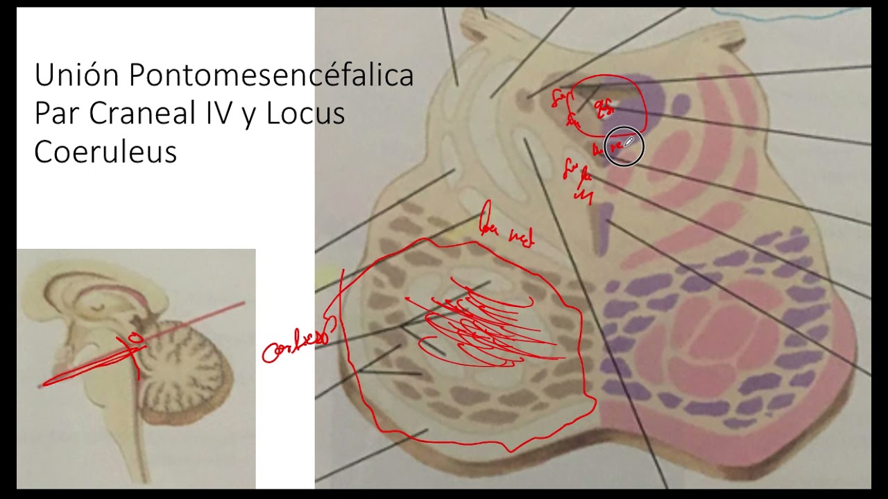 Cranial Nerve IV and Locus Coeruleus Cross Section Pontomesencephalic Junction Anatomy of the Ner...