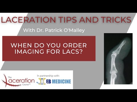 Imaging for lacerations