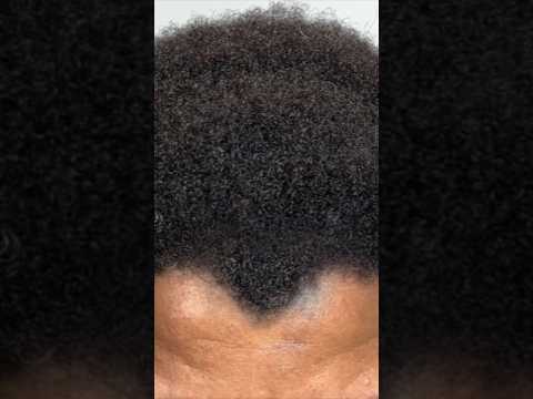 the MOST OVERGROWN widows peak I’ve ever seen 💈😳