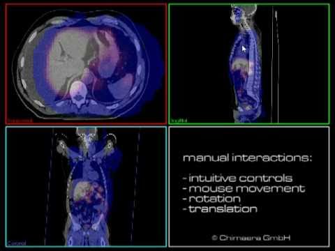 Medical Image Registration