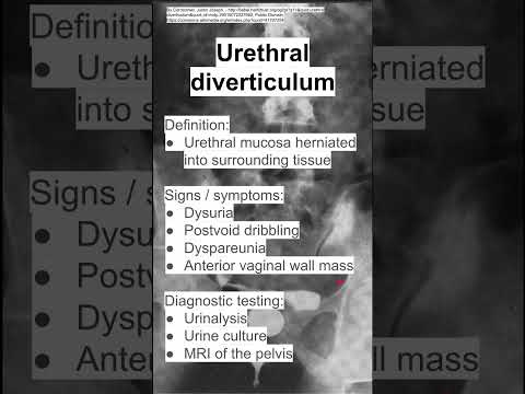Urethral diverticulum