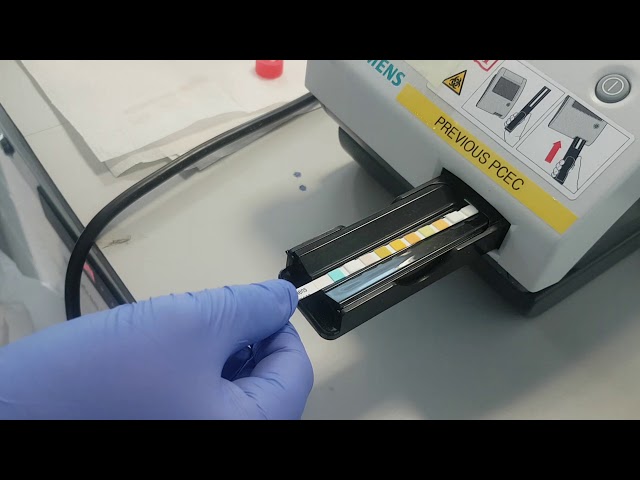 Urine Analyser - Siemens Urine Analyser with ACR Distributor / Channel ...