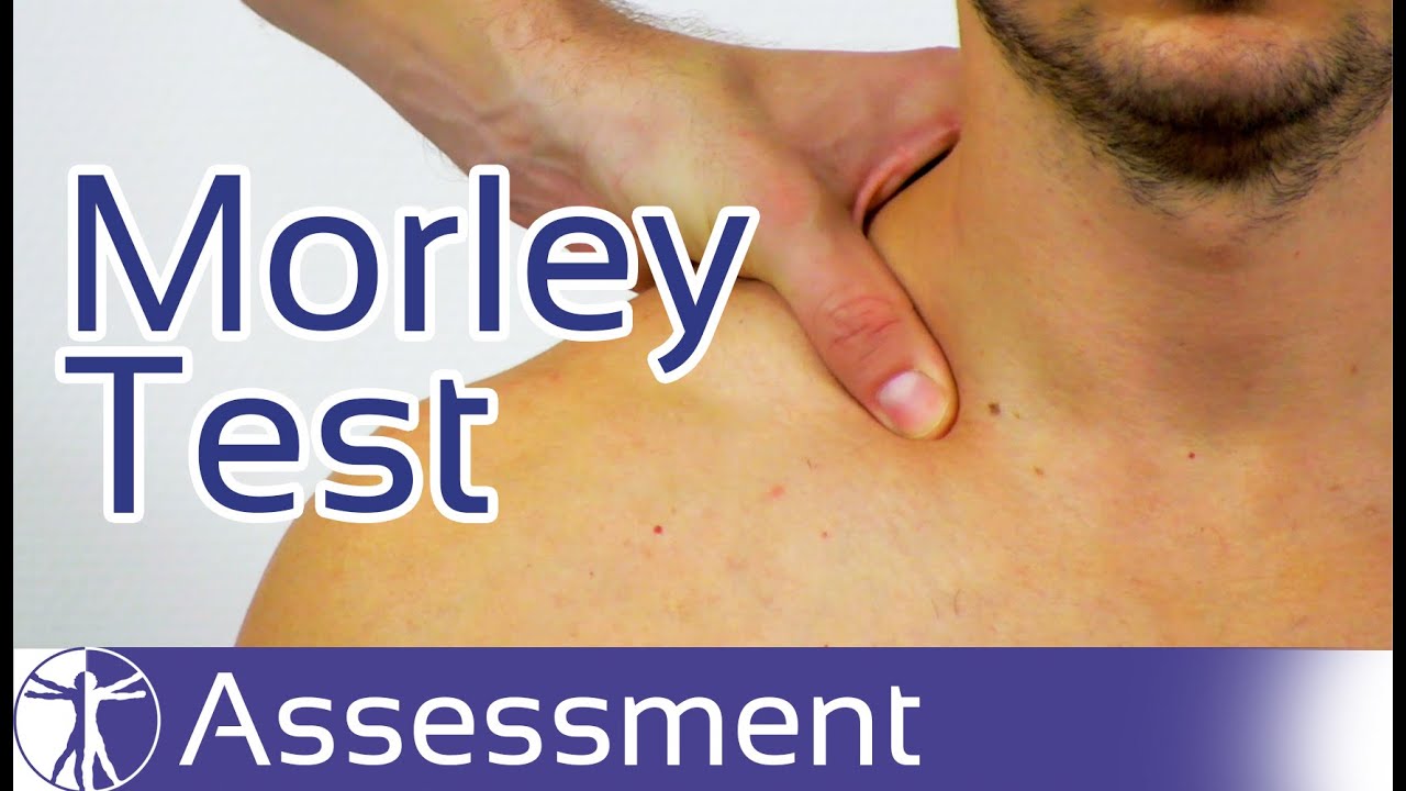 Morley Test / Brachial Plexus Compression Test | Thoracic Outlet Syndrome (TOS)