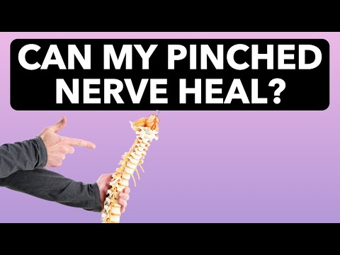 Can a Pinched Nerve In My Neck Heal?