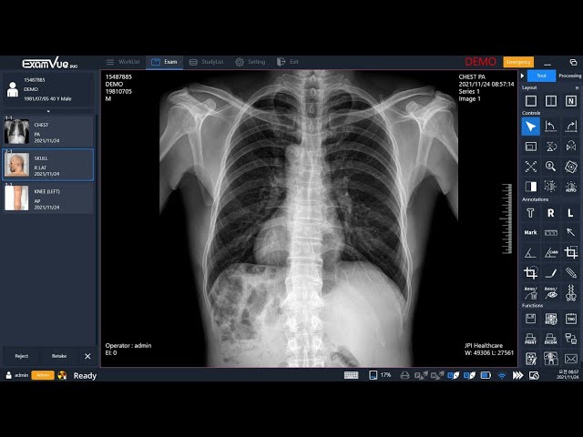 X Ray Machine - Portable X Ray Stand Manufacturer from Noida