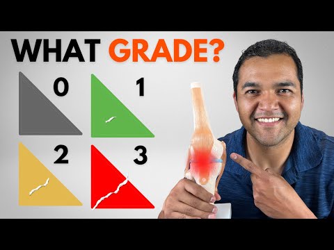 What is the Difference Between Grade 1, 2, and 3 Meniscus Tears?
