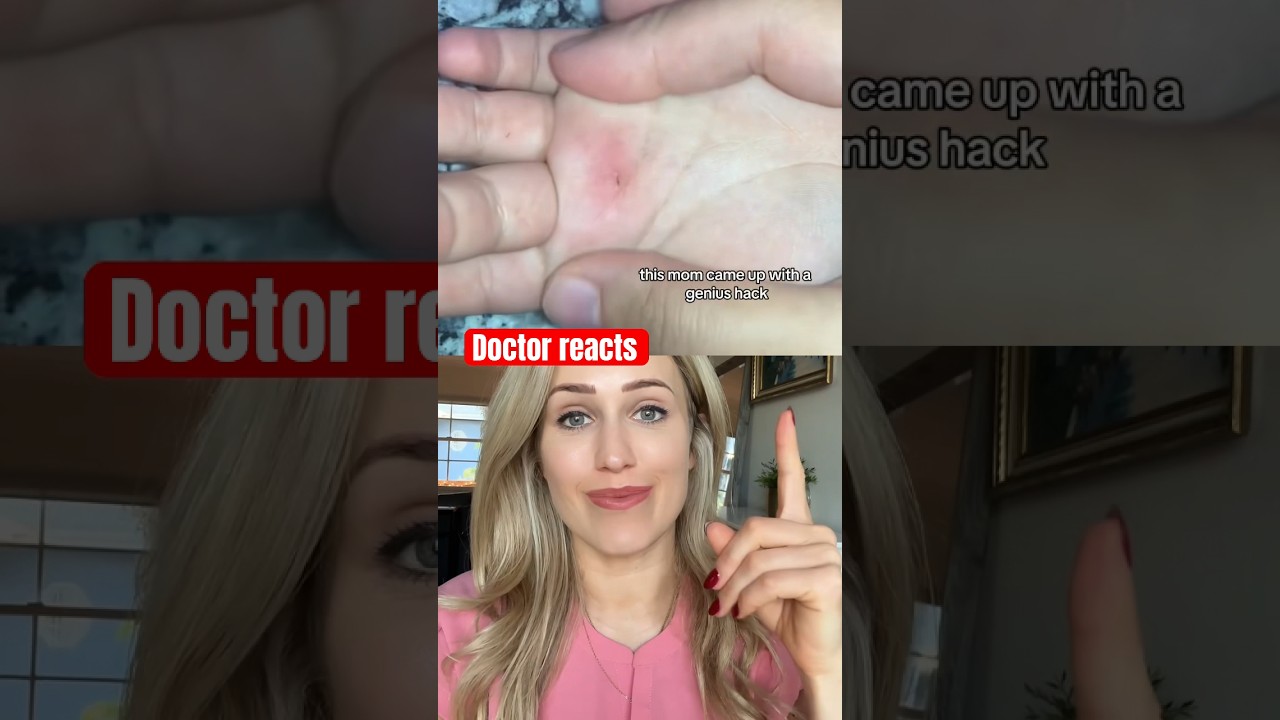 Doctor reacts: genius splinter life hack