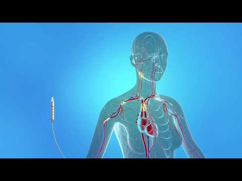 Fluorescein Angiography "English”