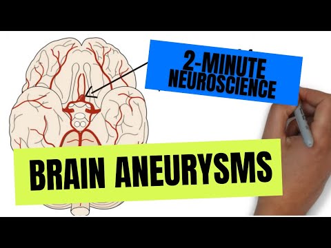 2-Minute Neuroscience: Brain Aneurysms