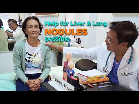 Help for Liver & Lung NODULES Possible