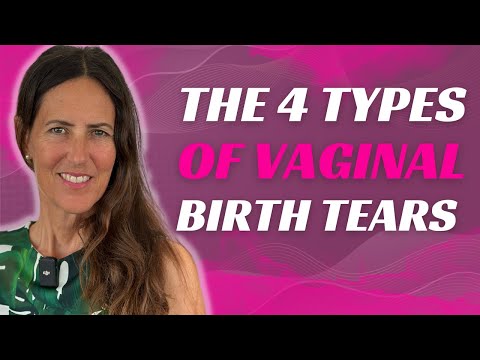 4 Types of Vaginal Birth Tears