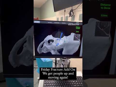 Friday Night Hip Fracture Gets Replaced | Dr. Robert Cagle