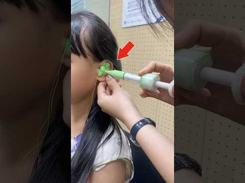 Viral ! Girls hearing aid mold making #shorts #ashortaday #tranding #facts #shortsfeed #vlog