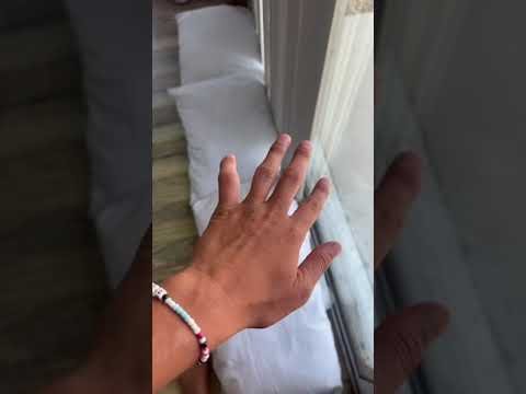 Update on my broken pinky…