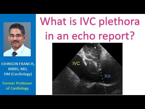 What is IVC plethora in an echo report?